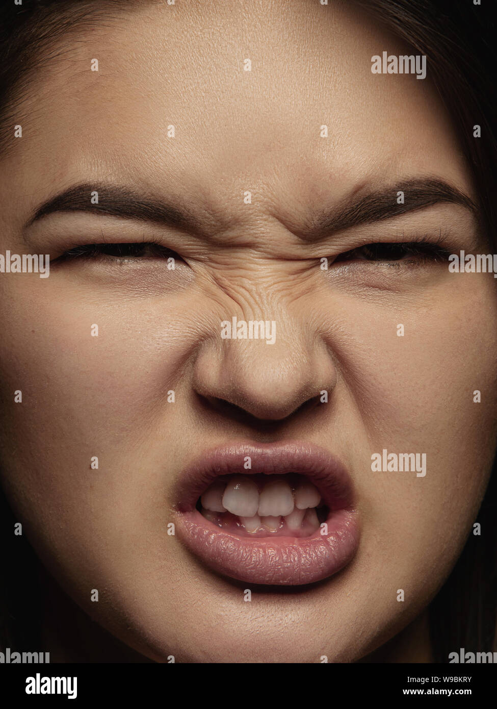 Facial scaring hi-res stock photography and images - Alamy