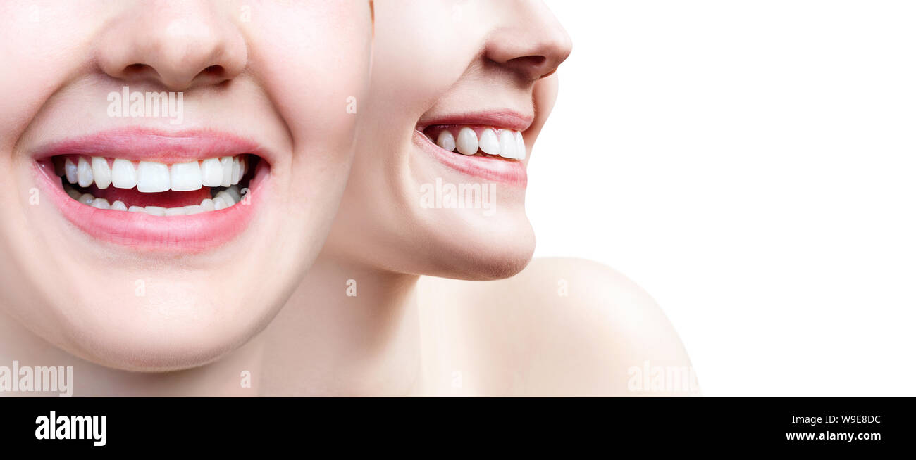 Collage of perfect female teeth closeup with text space Stock Photo - Alamy