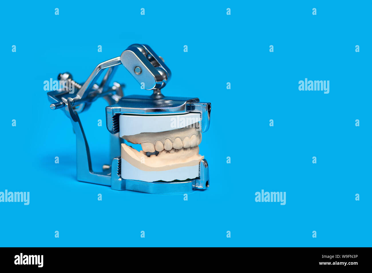 jaw cast in a special medical device on a blue background Stock Photo ...