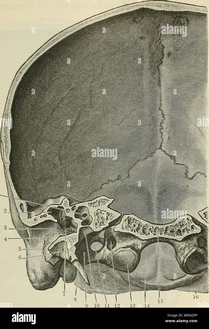 Middle Cranial Fossa Middle Cranial Fossa Quiz