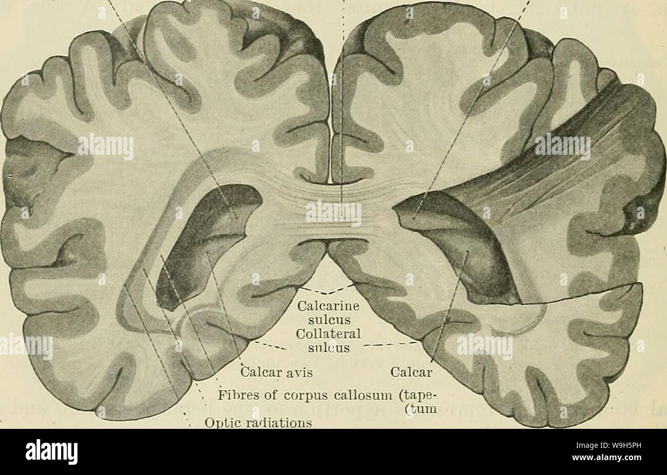 Temporal pole hi-res stock photography and images - Alamy