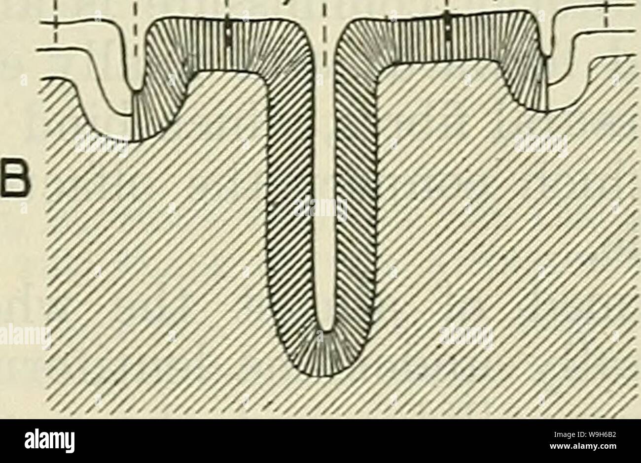 Operculated hi-res stock photography and images - Alamy