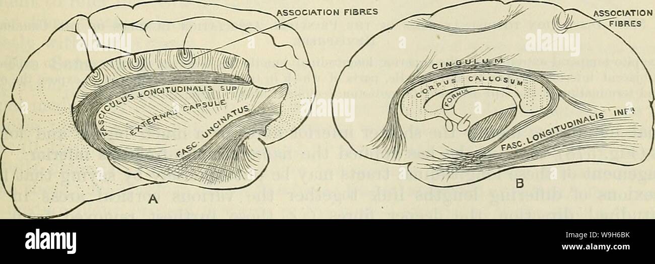 Anterior commissure hi-res stock photography and images - Alamy