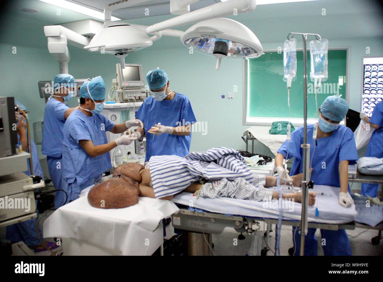 Chinese doctors examine Huang Chuncai, who suffers from huge tumor on ...