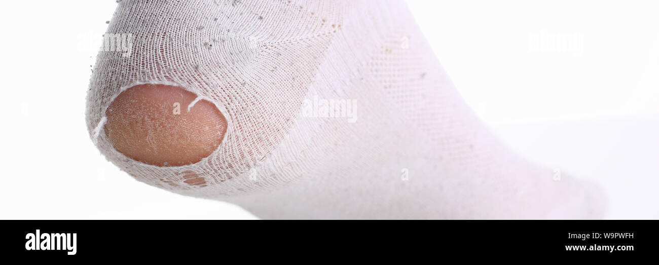 Ripped white sock on male leg isolated Stock Photo - Alamy
