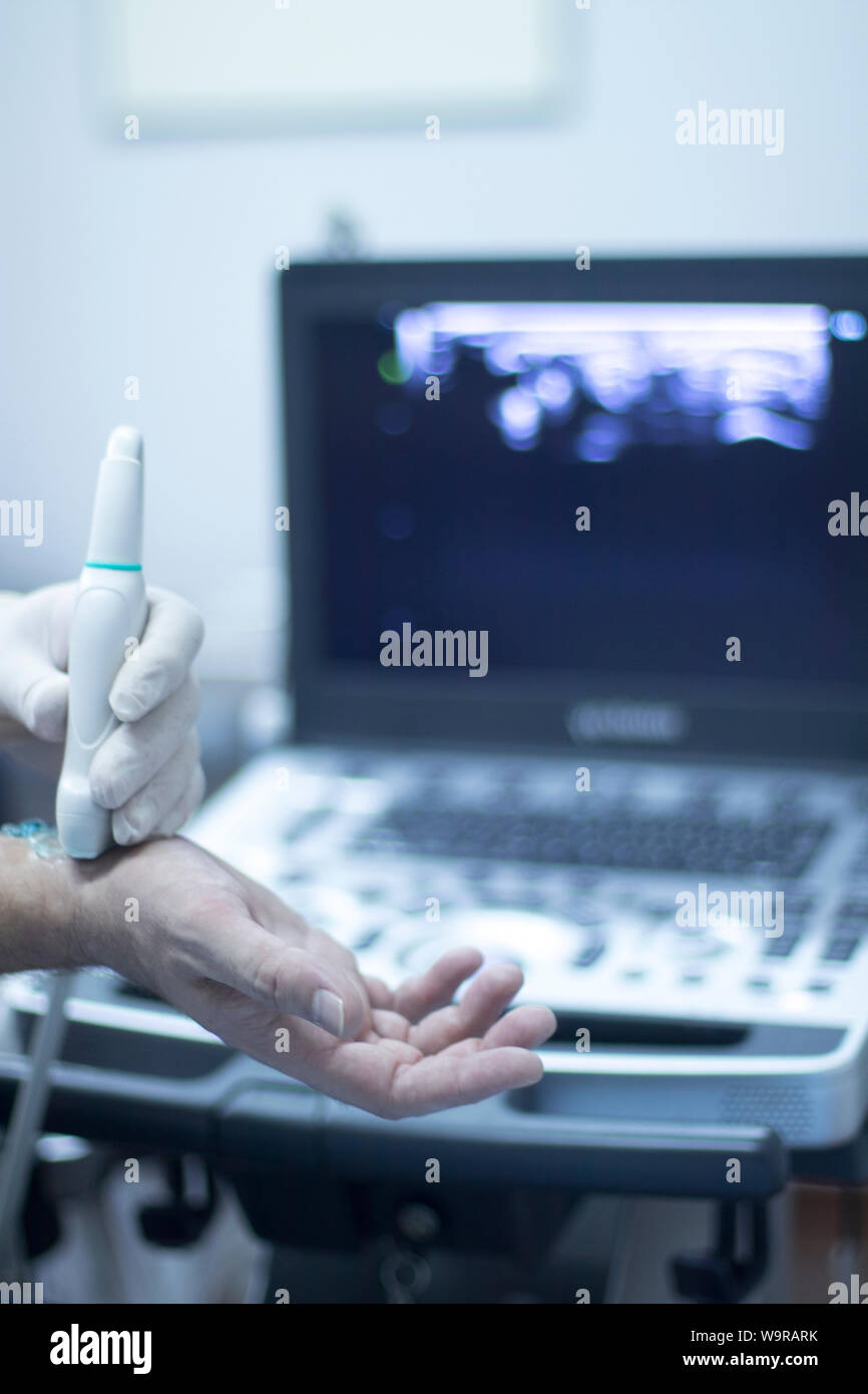 EPI Intratissue Percutaneous Electrolysis dry needling ultrasound ...