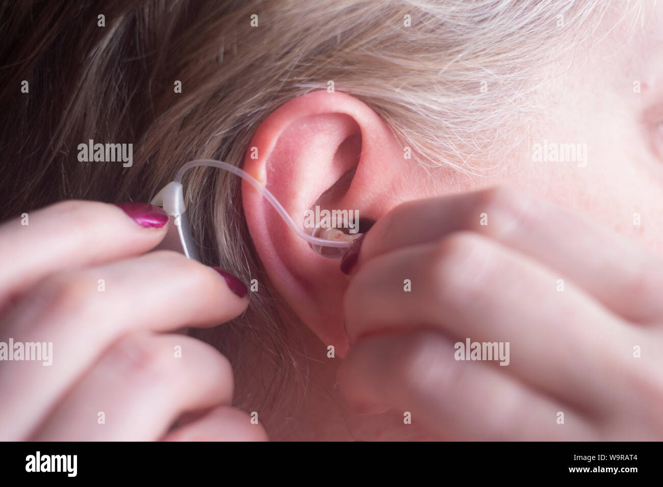 Digital modern technology for deaf people micro hearing aid Stock Photo ...