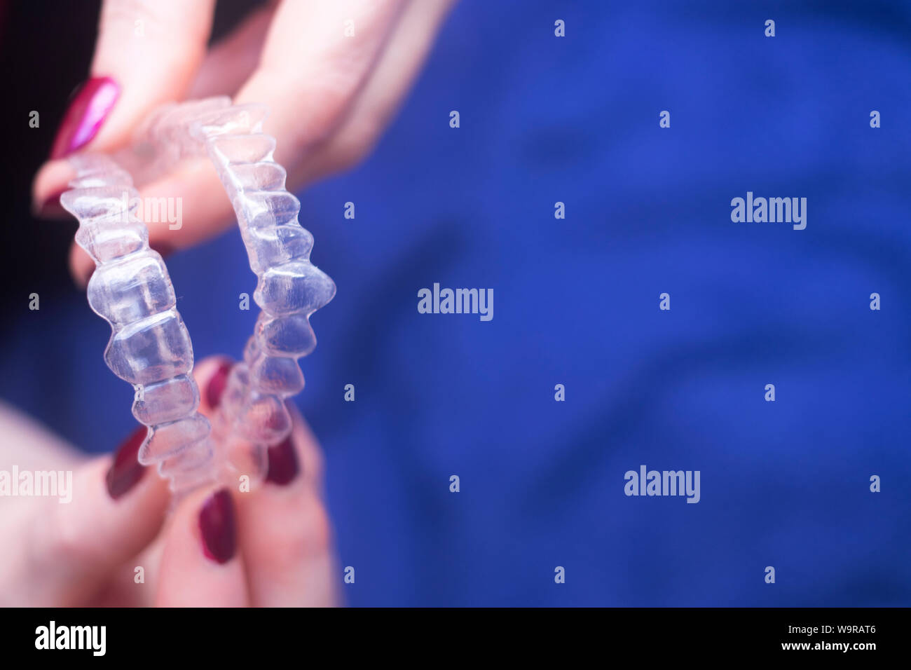 Clear dental teeth retainer brackets to straighten and align each tooth ...