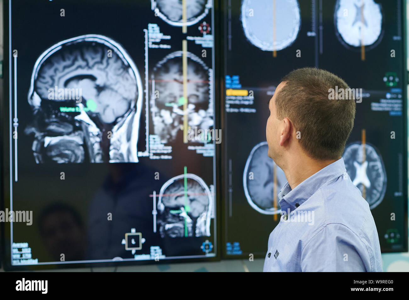 Neuroimaging Stock Photos & Neuroimaging Stock Images - Alamy