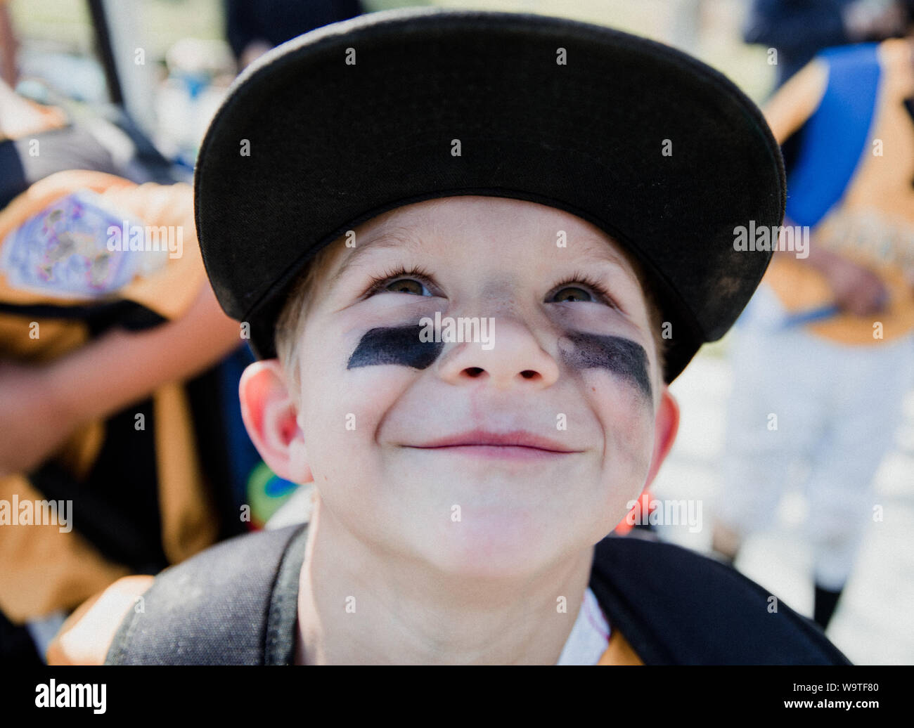 Boy with black eye hi-res stock photography and images - Alamy