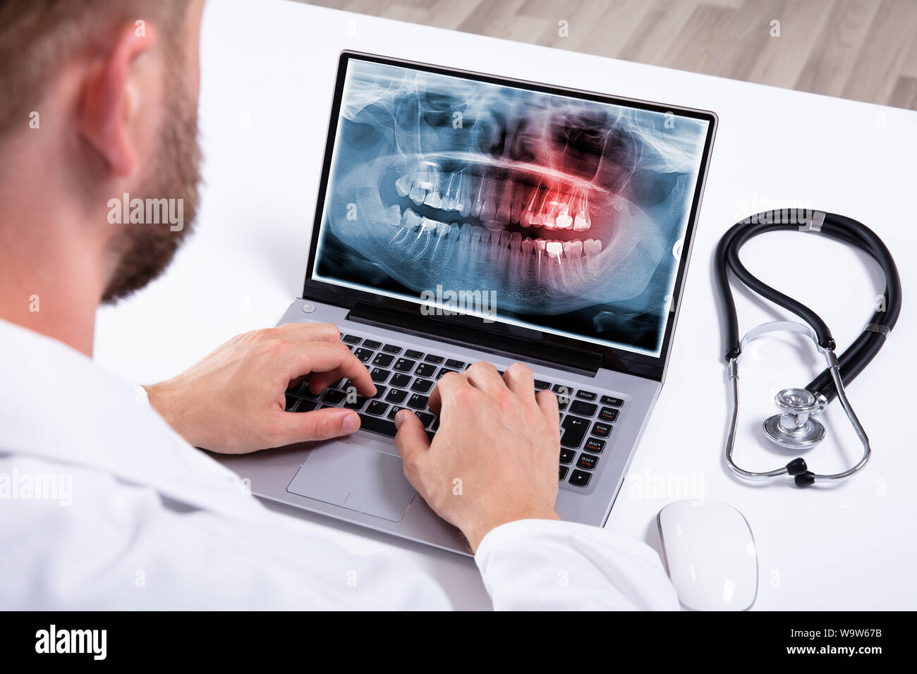 Doctor Looking At Teeth X-ray On Computer Stock Photo - Alamy