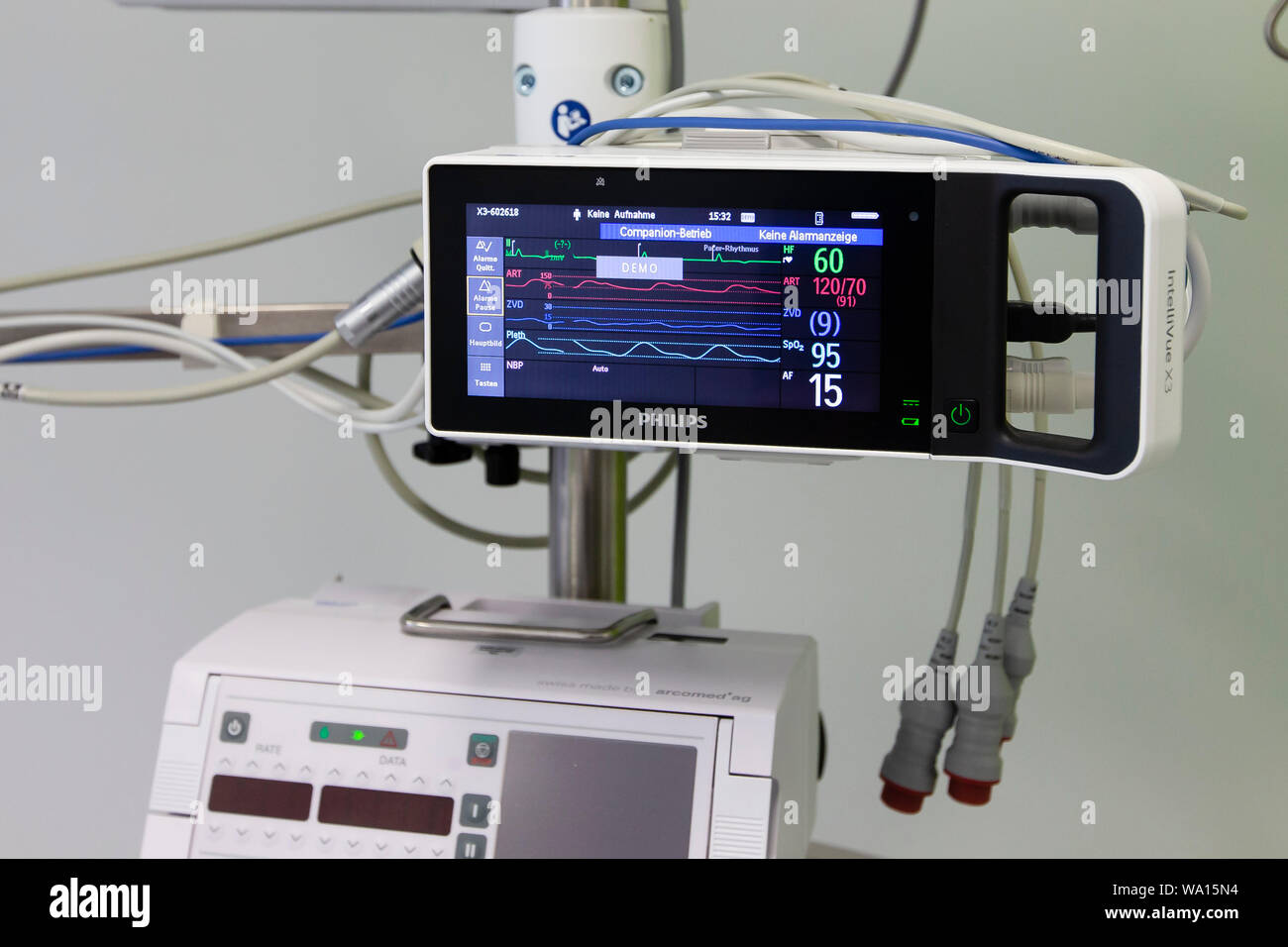 Measuring Central Venous Pressure