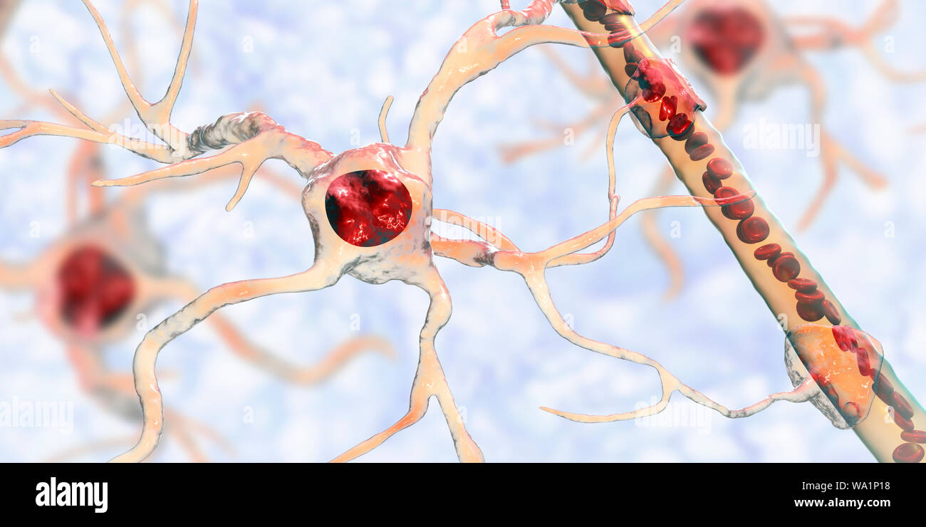 Astrocyte and blood vessel, computer illustration. Astrocytes, brain ...