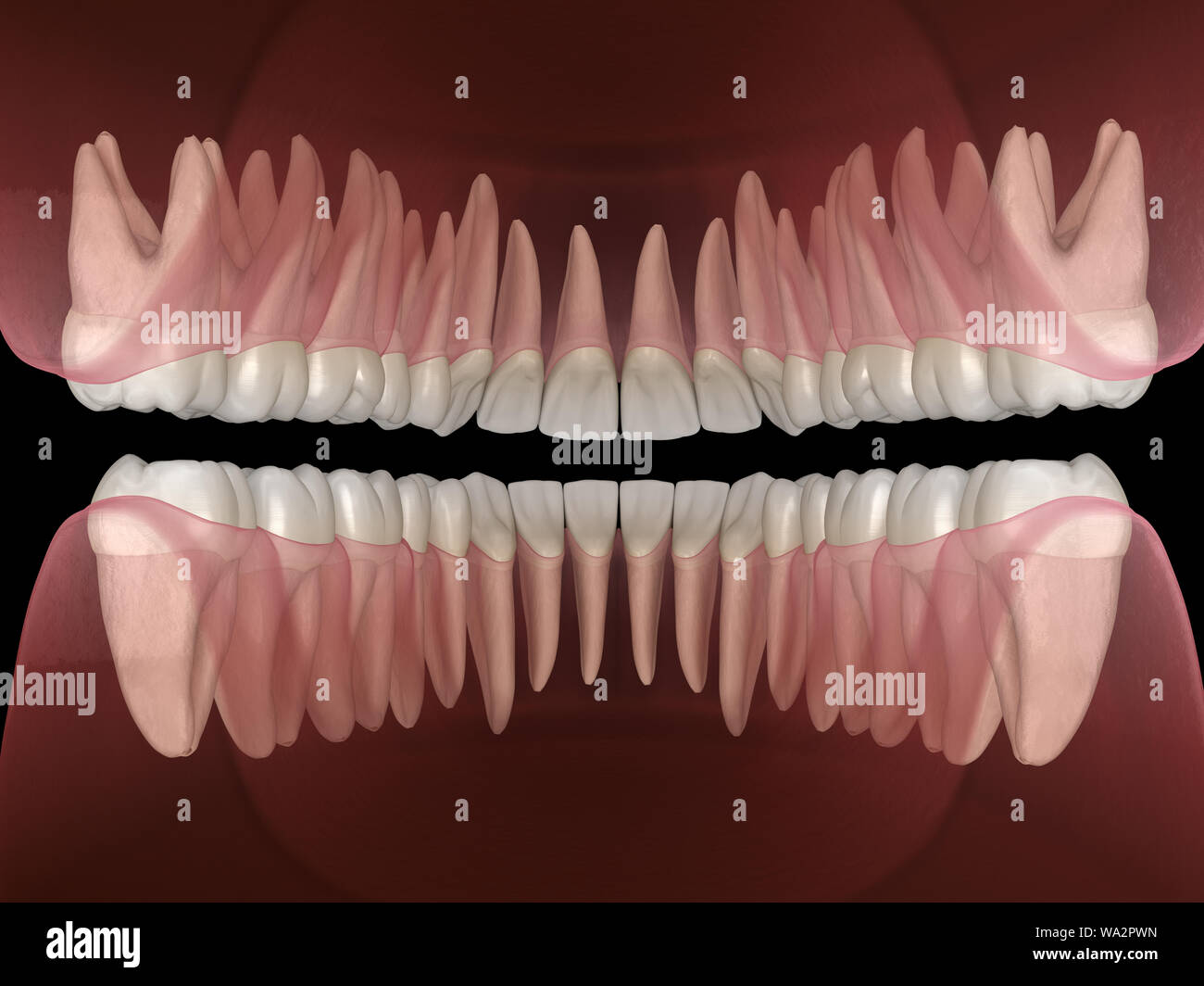 Morphology of mandibular and maxillary human gum and teeth. Medically ...