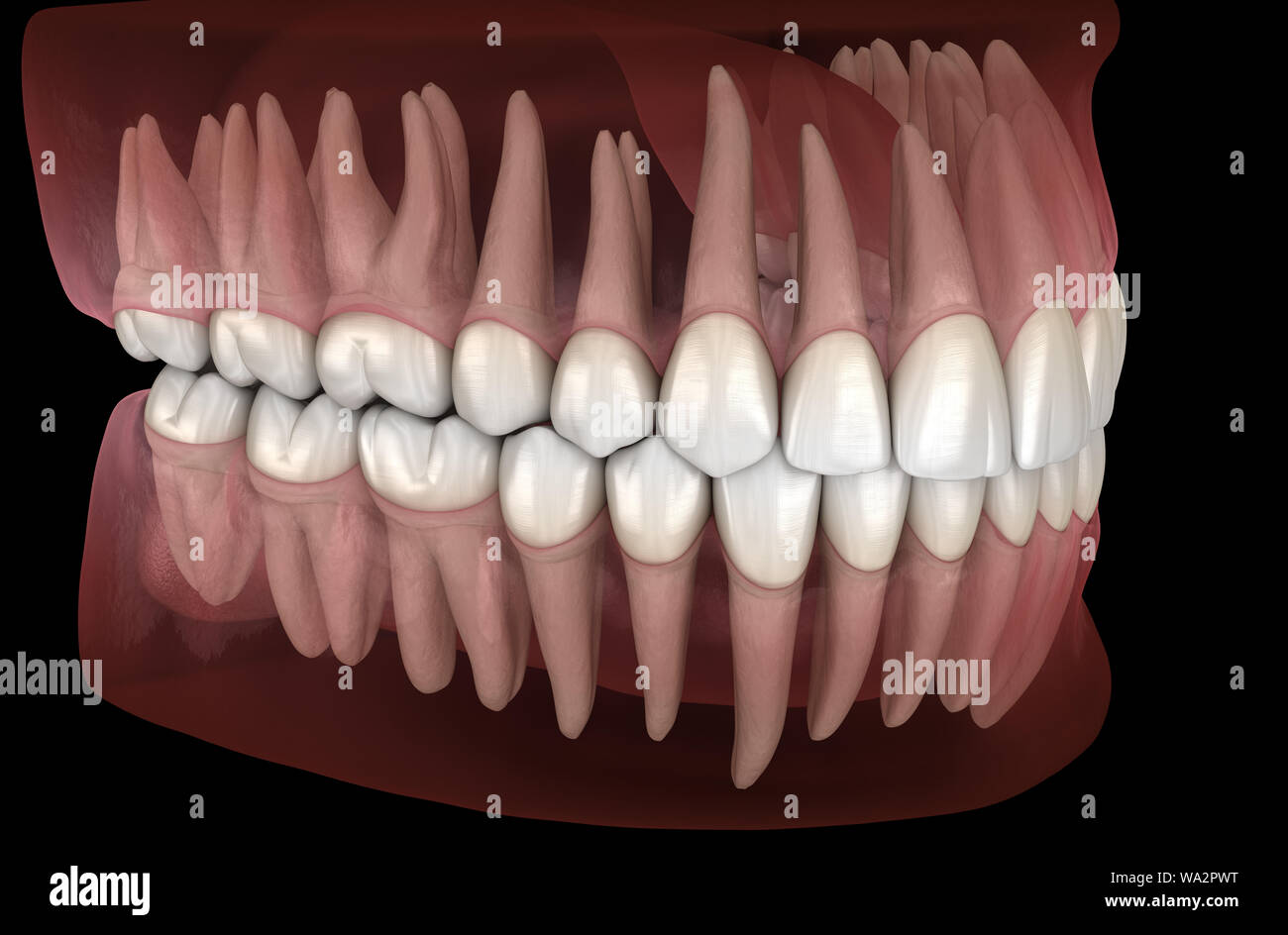 Morphology of mandibular and maxillary human gum and teeth. Medically ...