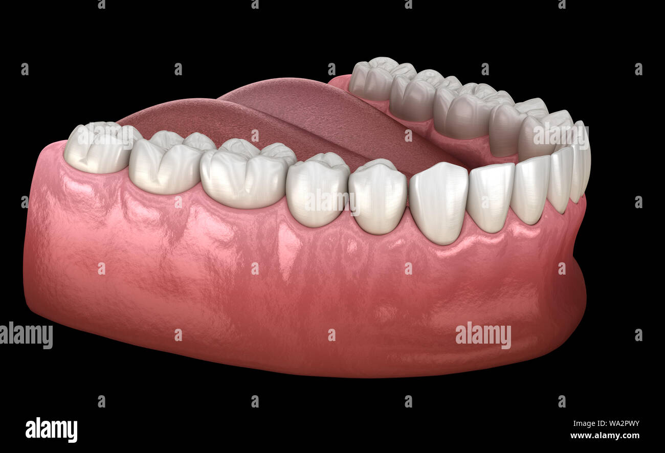 Mandibular human gum and teeth. Medically accurate tooth 3D ...