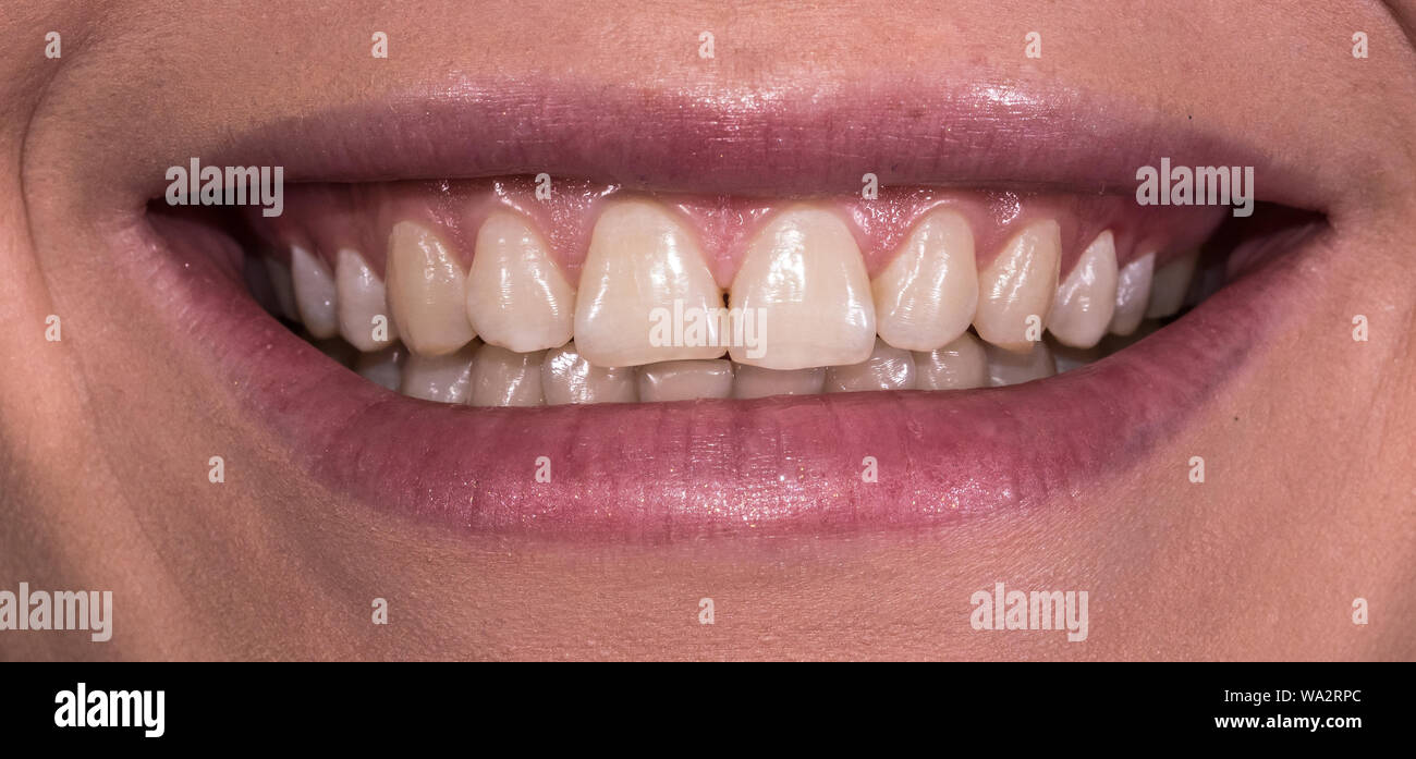 Woman smile with great natural teeth Stock Photo - Alamy