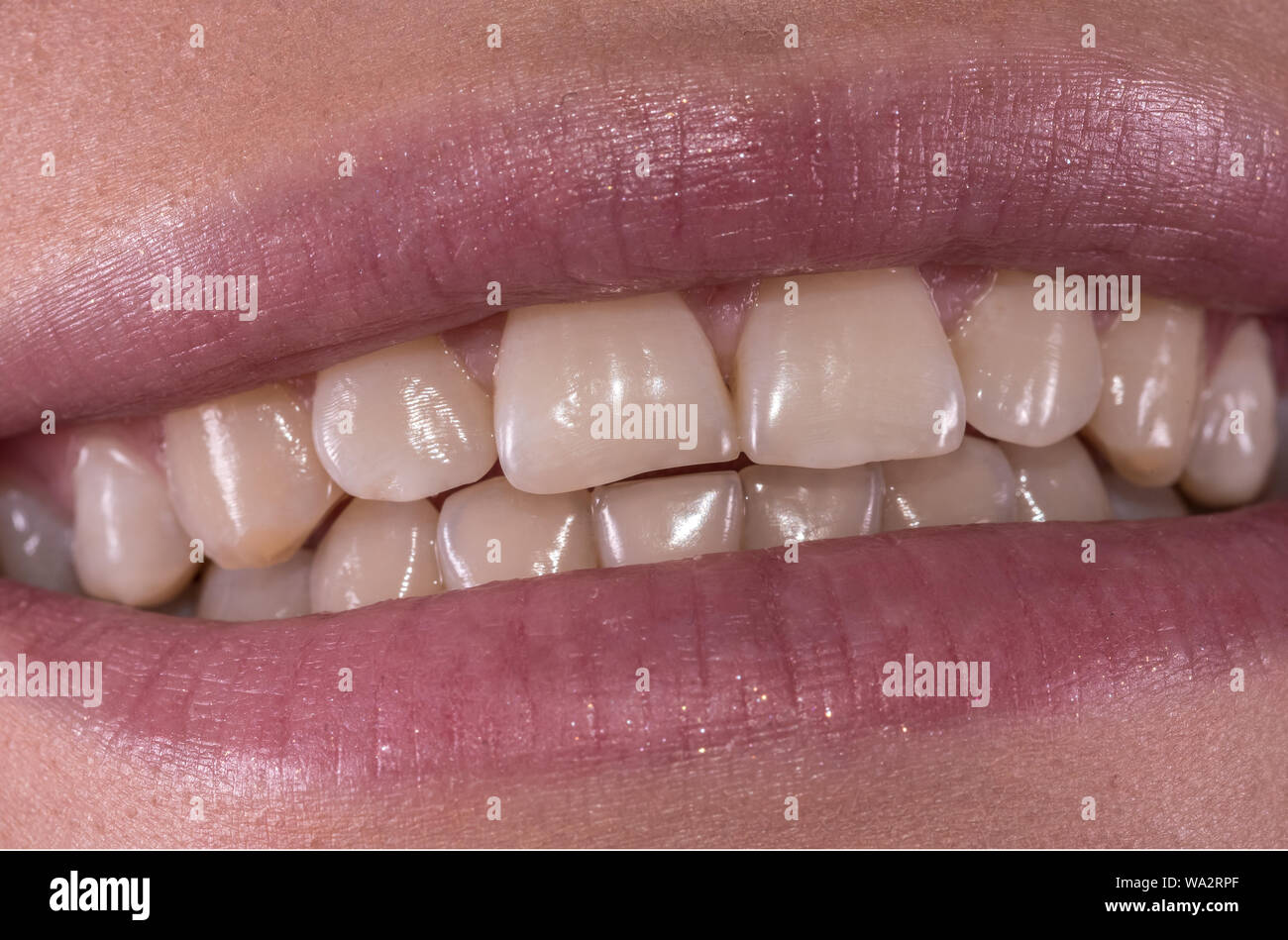 Woman smile with great natural teeth Stock Photo - Alamy