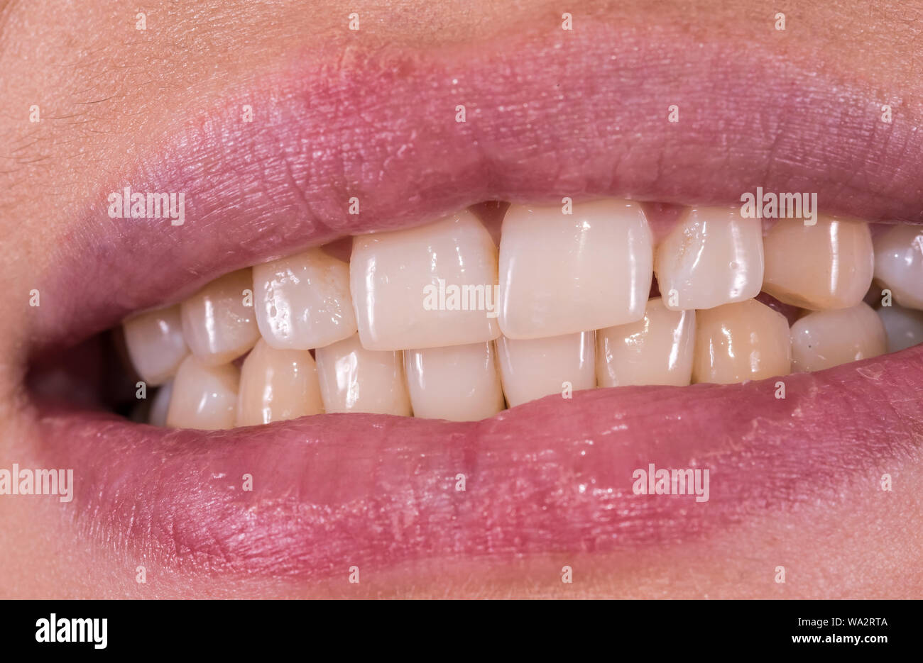 Woman smile with great natural teeth Stock Photo - Alamy