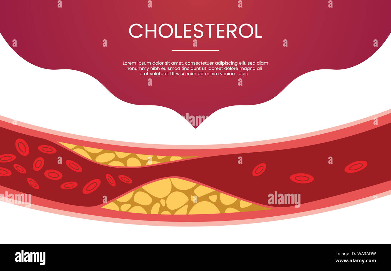 cholesterol human vein concept theme for template banner or landing ...