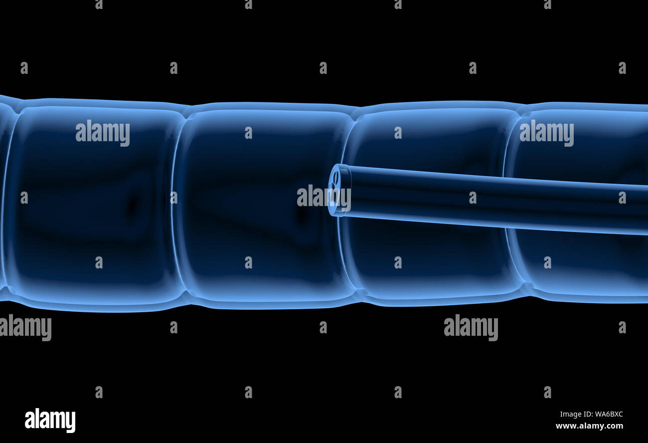 Colonoscopy technology concept with 3d rendering x-ray endoscope inside ...