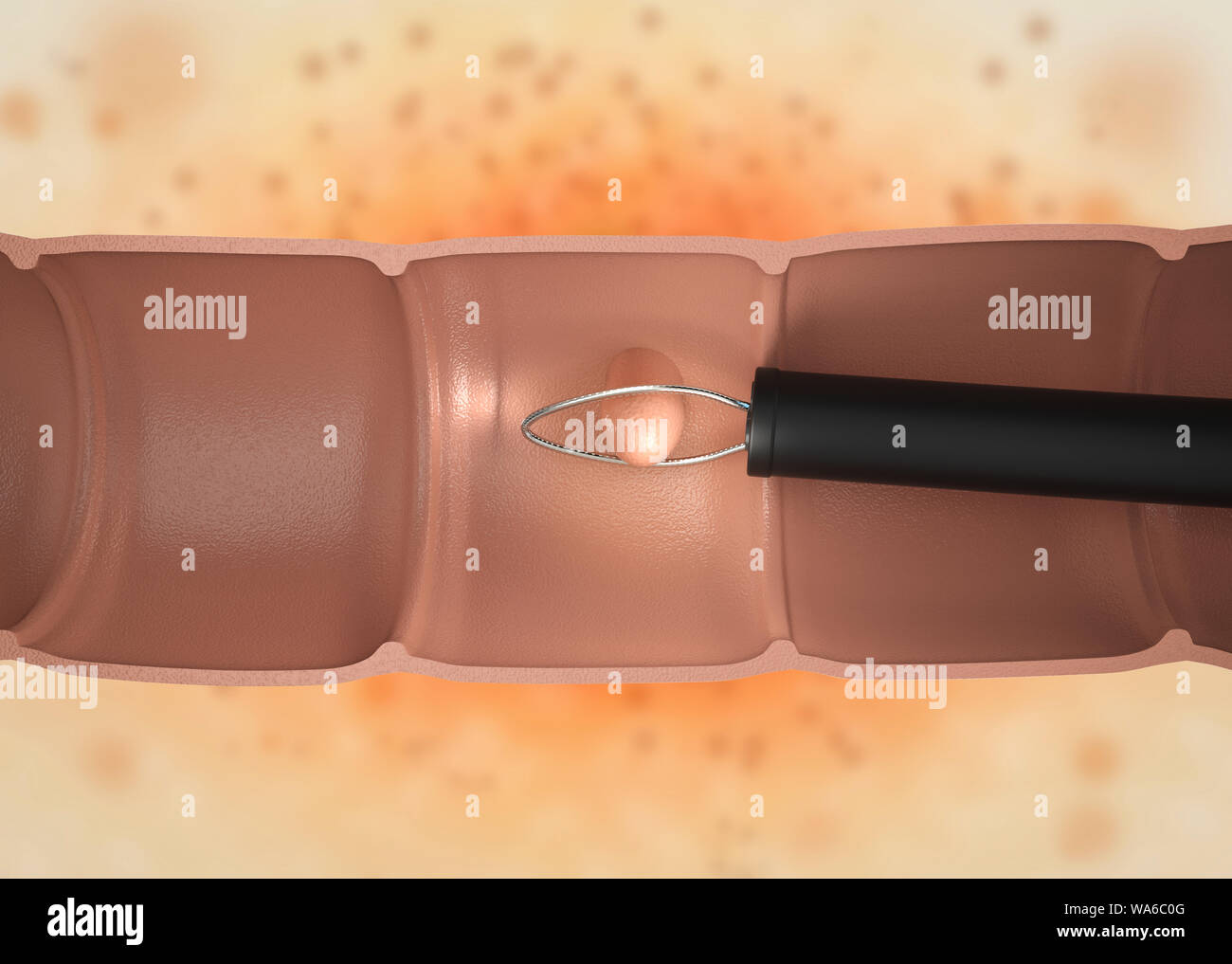 Loop of gut abdomen hi-res stock photography and images - Alamy