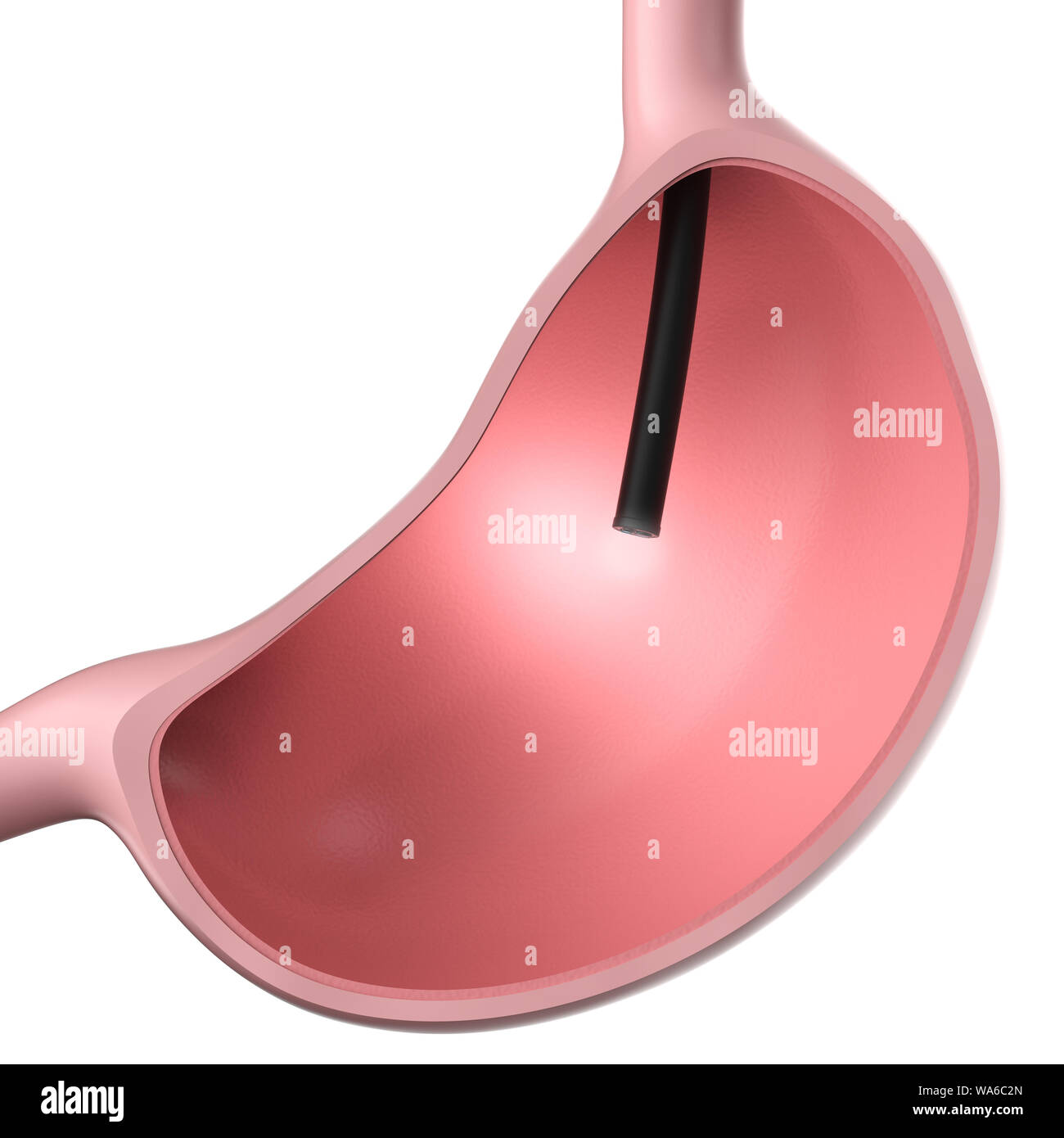 Endoscope camera hi-res stock photography and images - Alamy