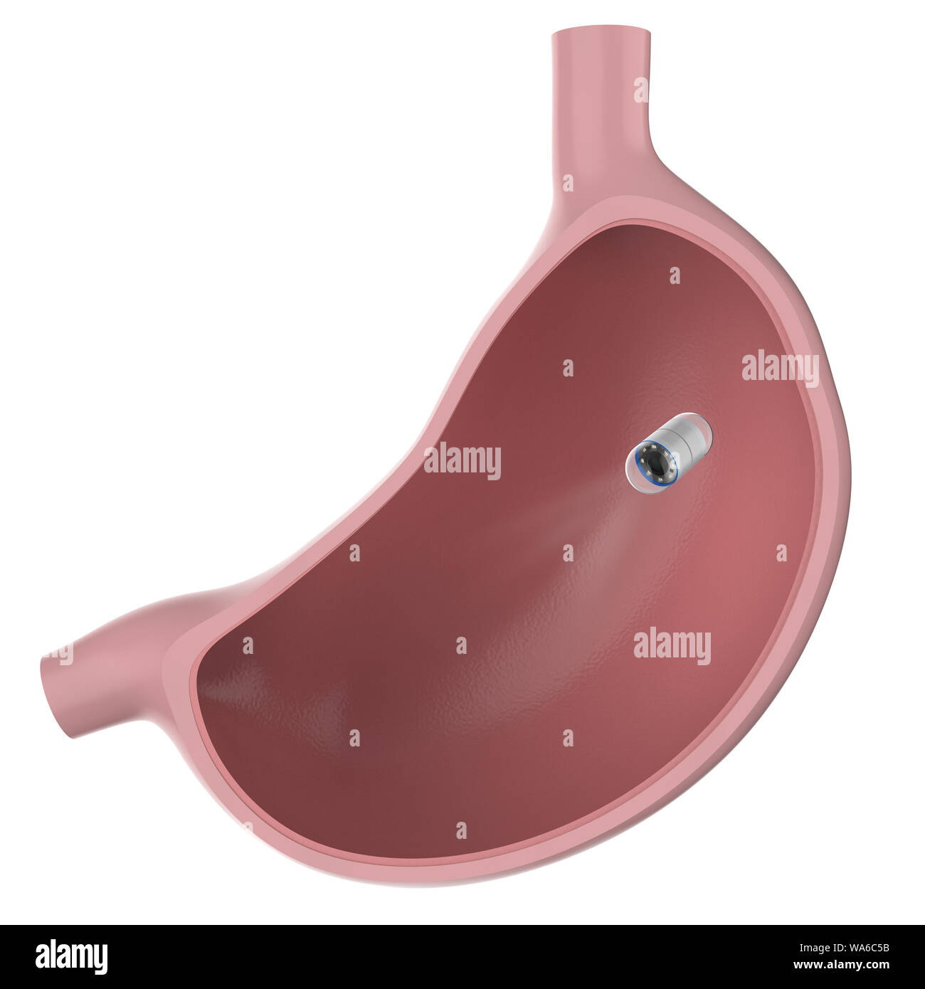 Gastric ulcer endoscopy hi-res stock photography and images - Alamy