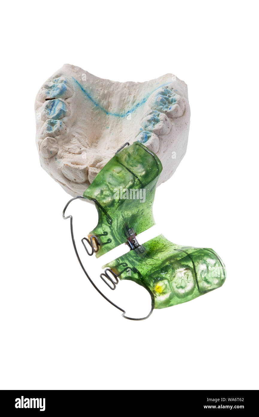 cast of the lower jaw isolated on white background Stock Photo - Alamy