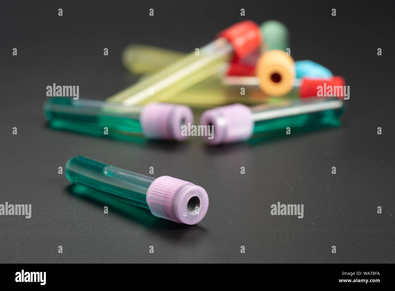 Test tubes with chemical samples in science laboratory Stock Photo - Alamy