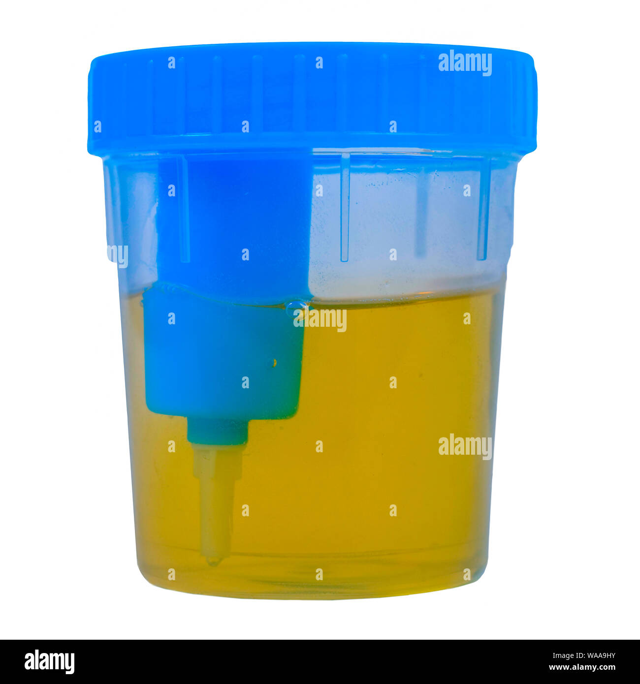 Cutout of an sterile Urine sample cup, containing a urine sample close ...