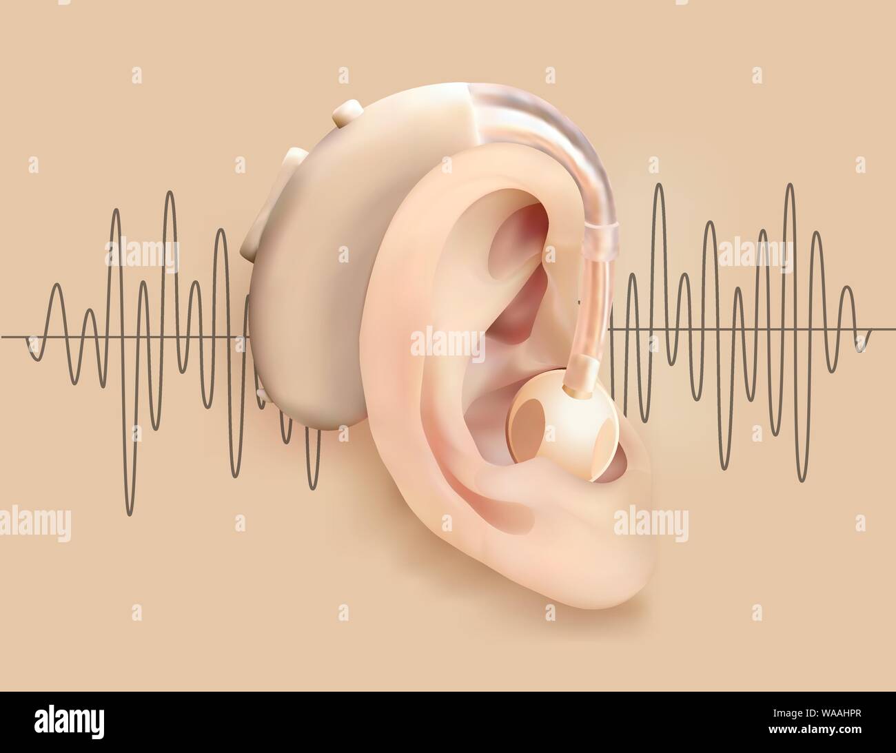 Hearing aid behind ear. Ear and sound amplifier on background of sound ...