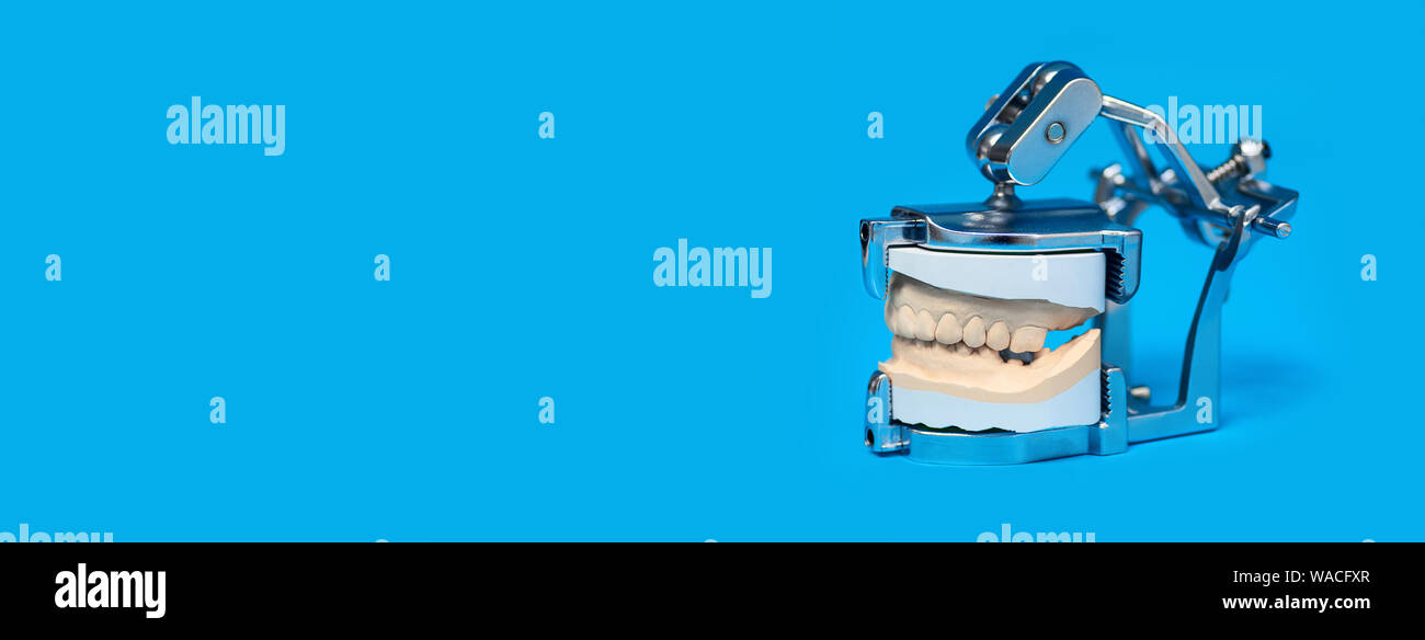 jaw cast in a special medical device on a blue background Stock Photo ...