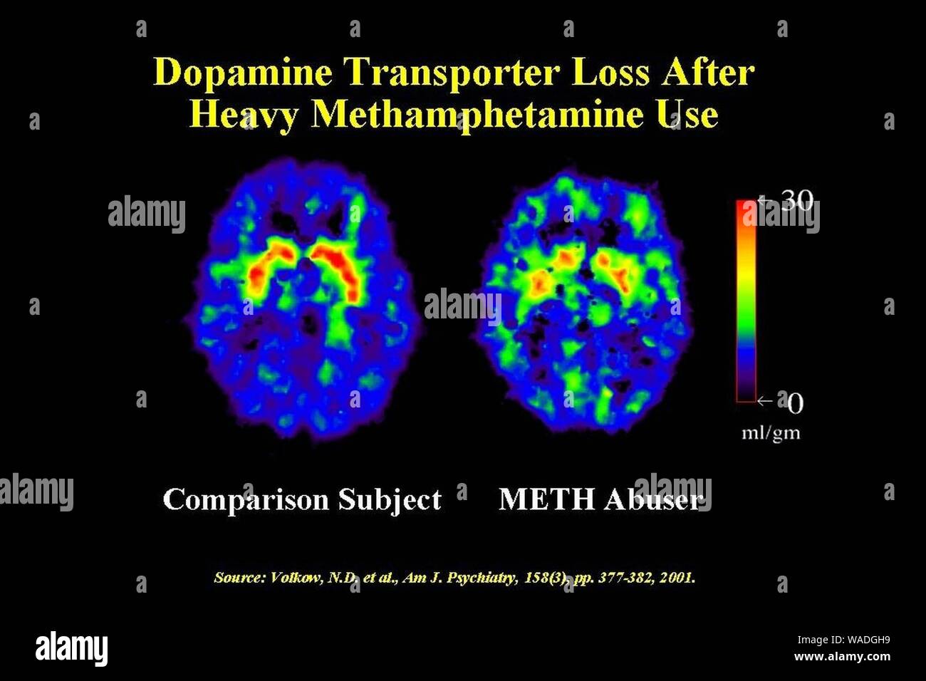 Dopamine transporter hi-res stock photography and images - Alamy