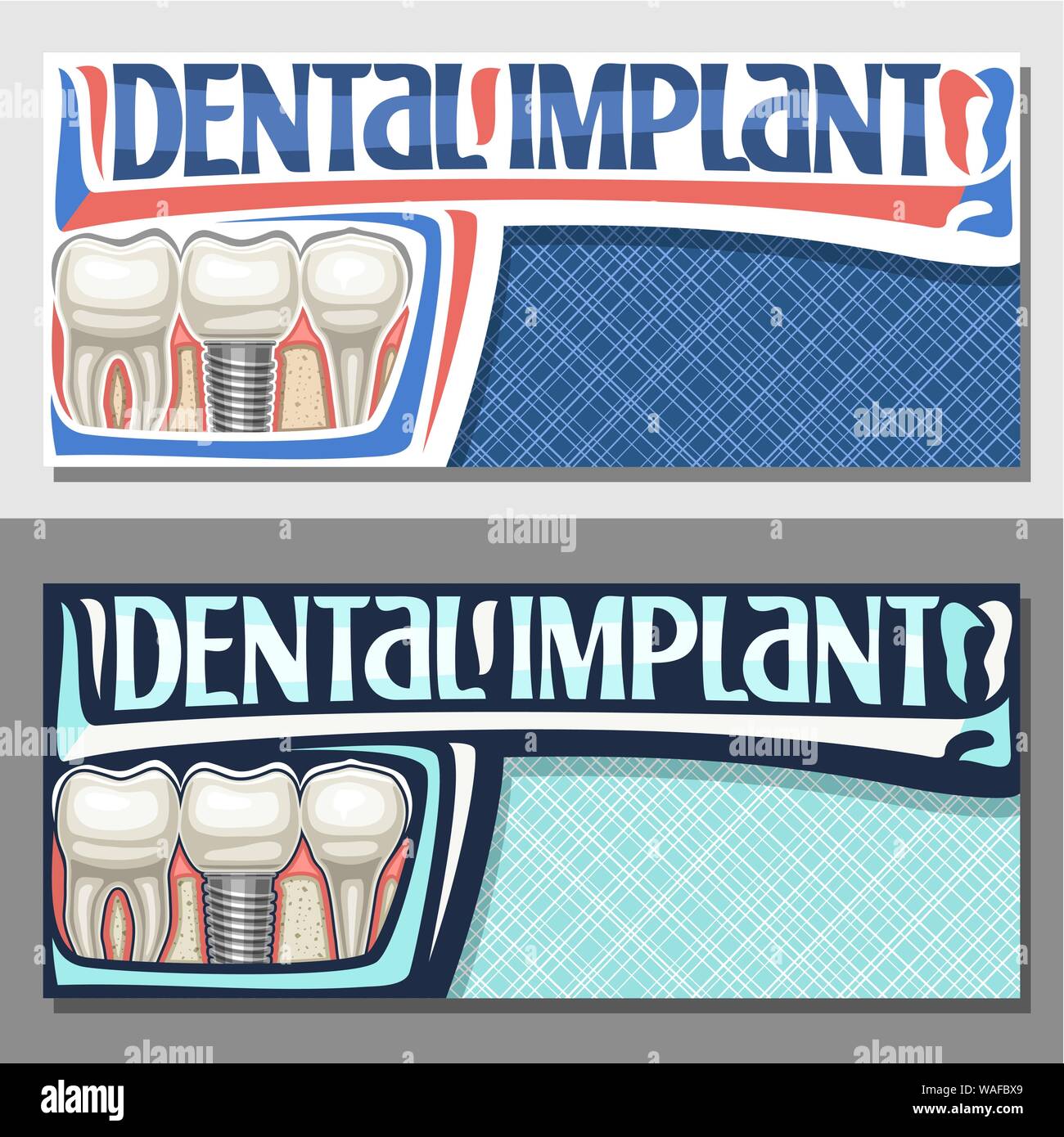 Vector banners for Dental Implant with copy space, layouts with 3 ...