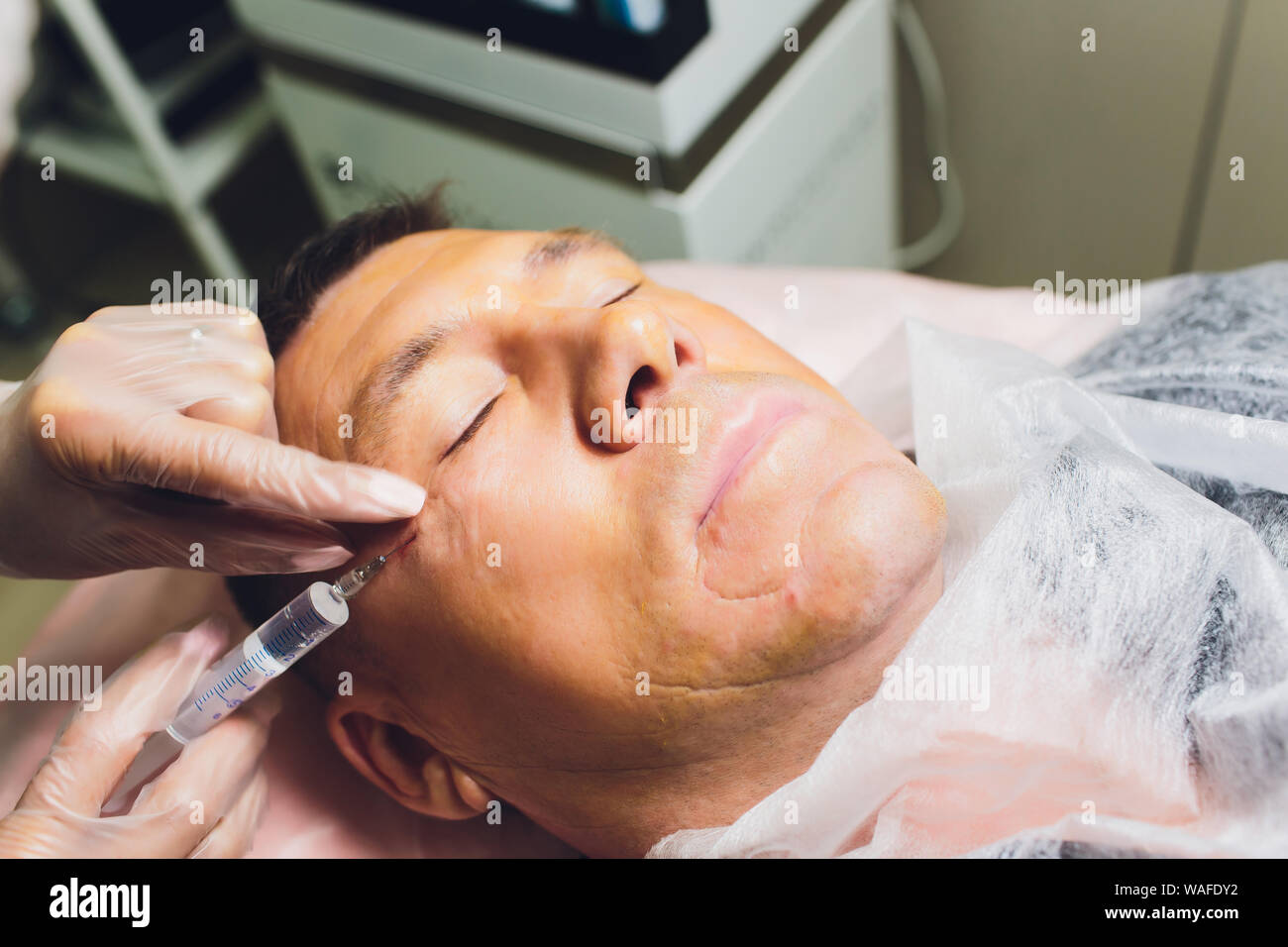 Close-up of procedure for face lifting PDO Suture operation, face ...