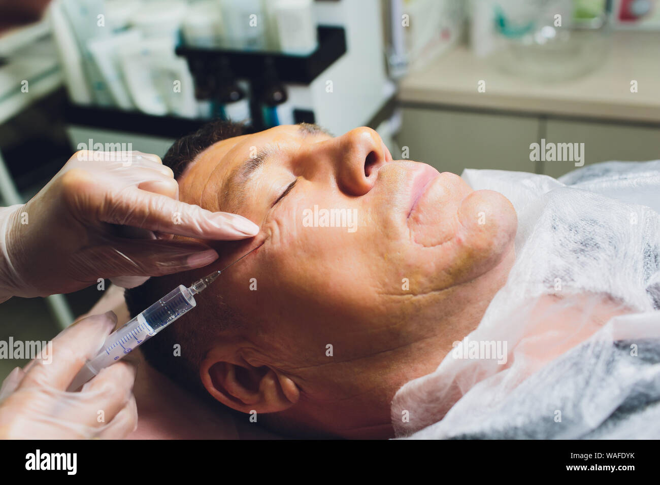 Close-up of procedure for face lifting PDO Suture operation, face ...