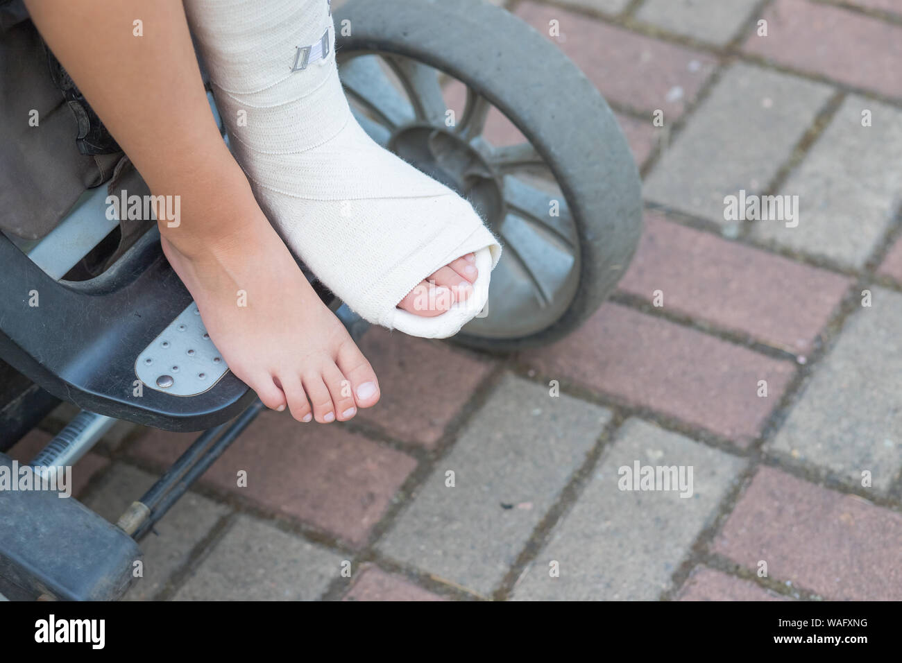 Male Broken Leg Hospital Stock Photos & Male Broken Leg Hospital Stock ...
