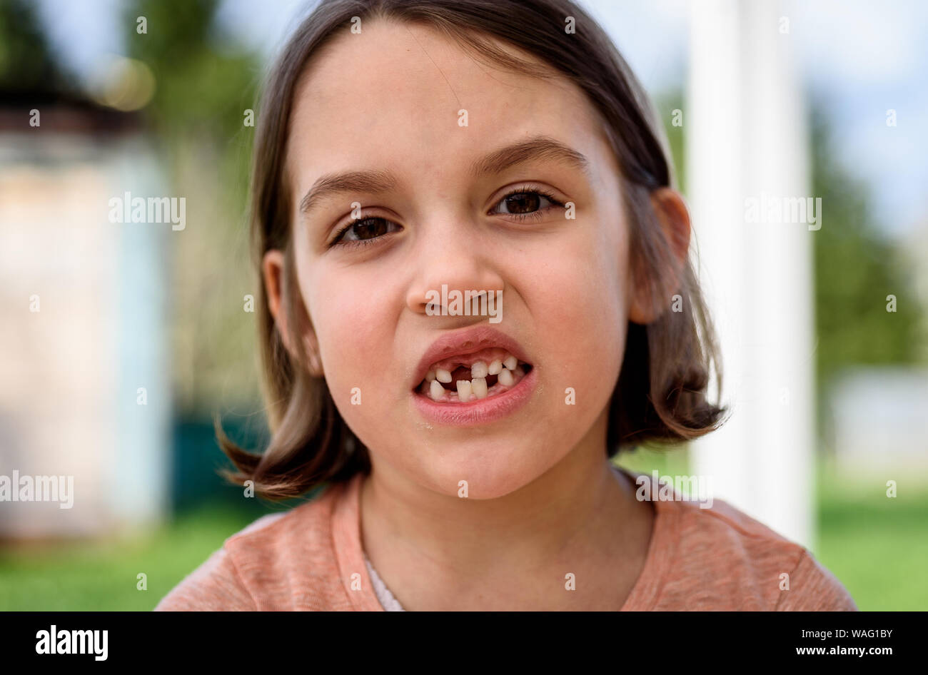 Missing toothless mouth hi-res stock photography and images - Alamy