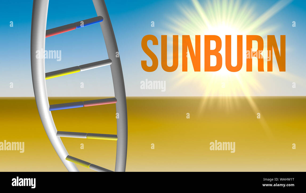Sunburn risk factor for DNA damages concept. 3D render illustration ...
