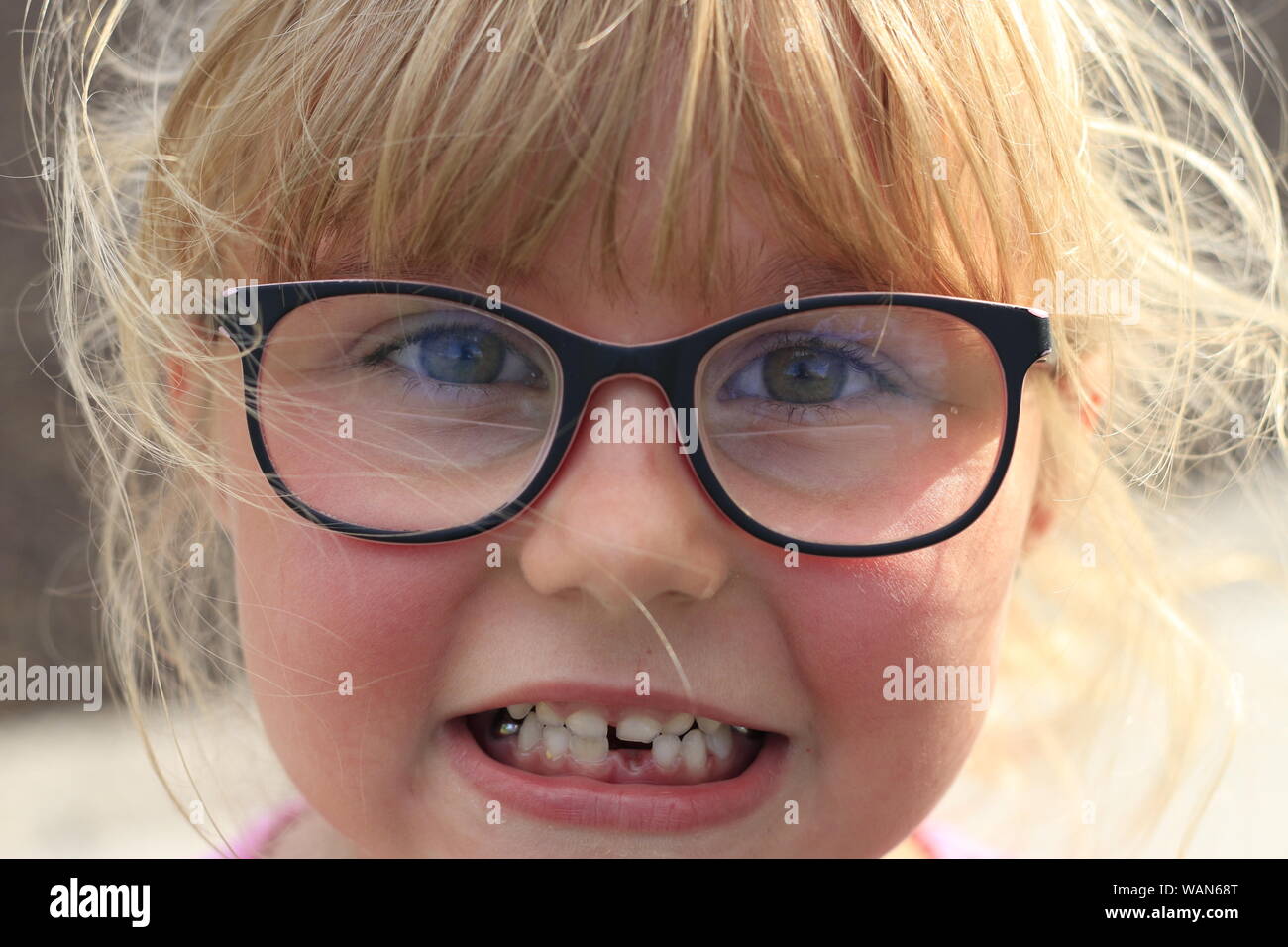 Little girl smiling outside showing her missing middle tooth Stock ...