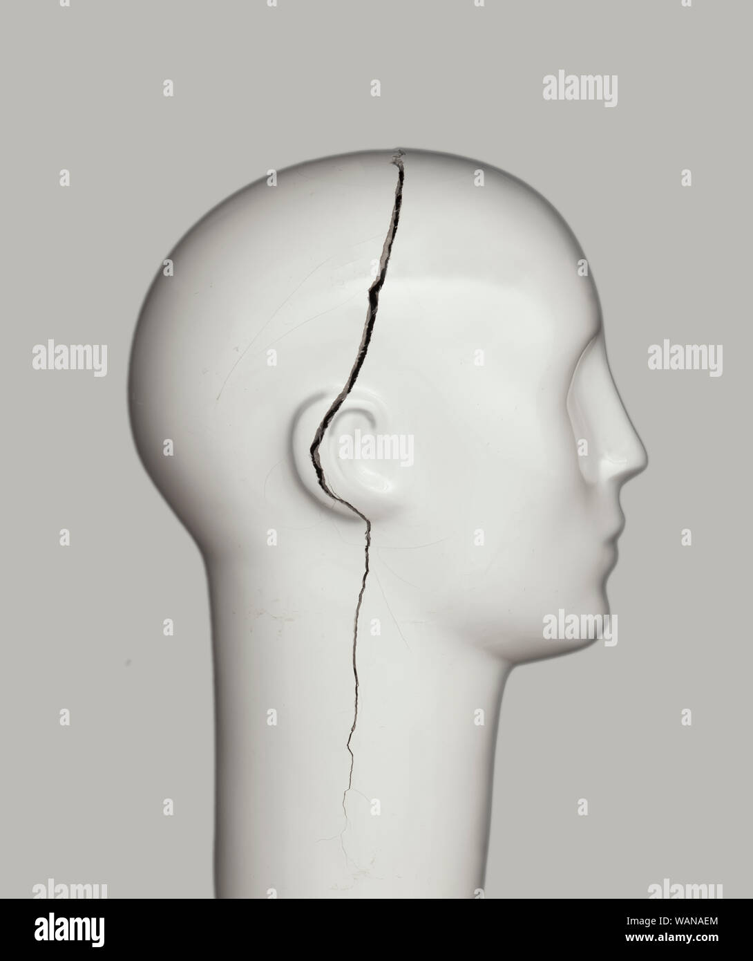 Splitting head ache hi-res stock photography and images - Alamy