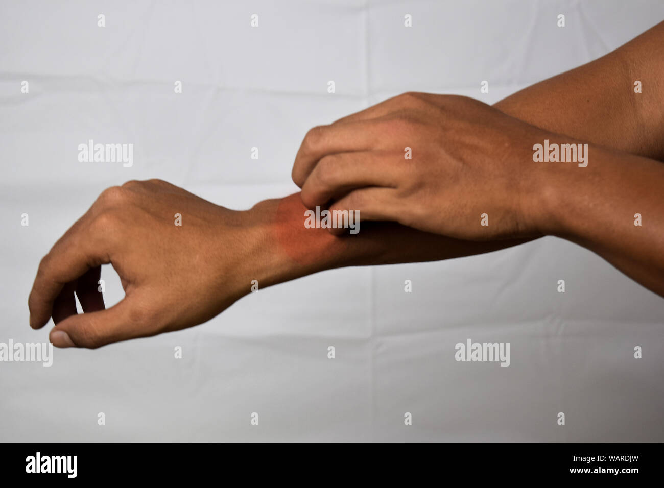 Close up Asian man scratch the itch with hand isolated on white ...