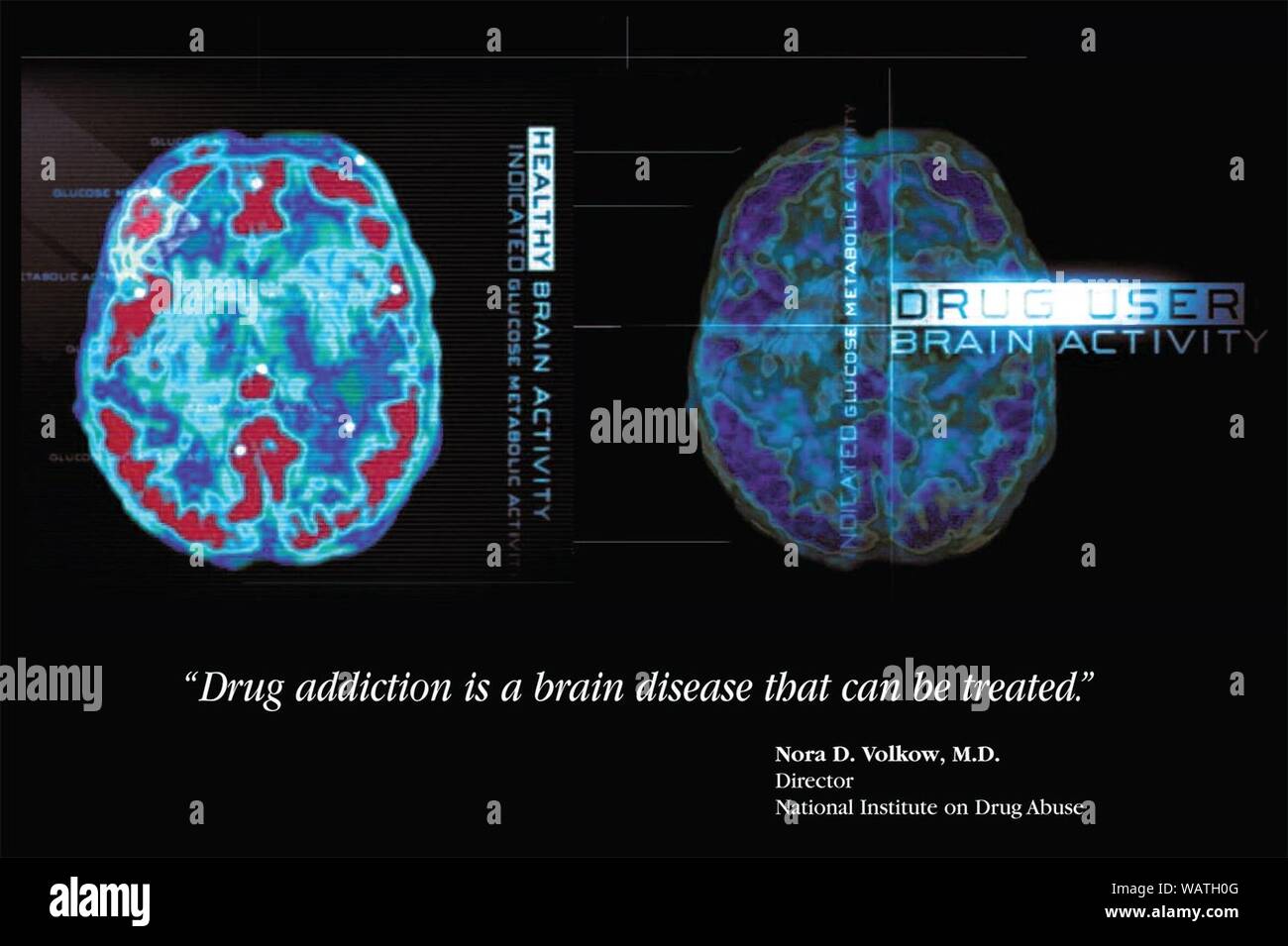 Drug Brain Activity Stock Photo - Alamy