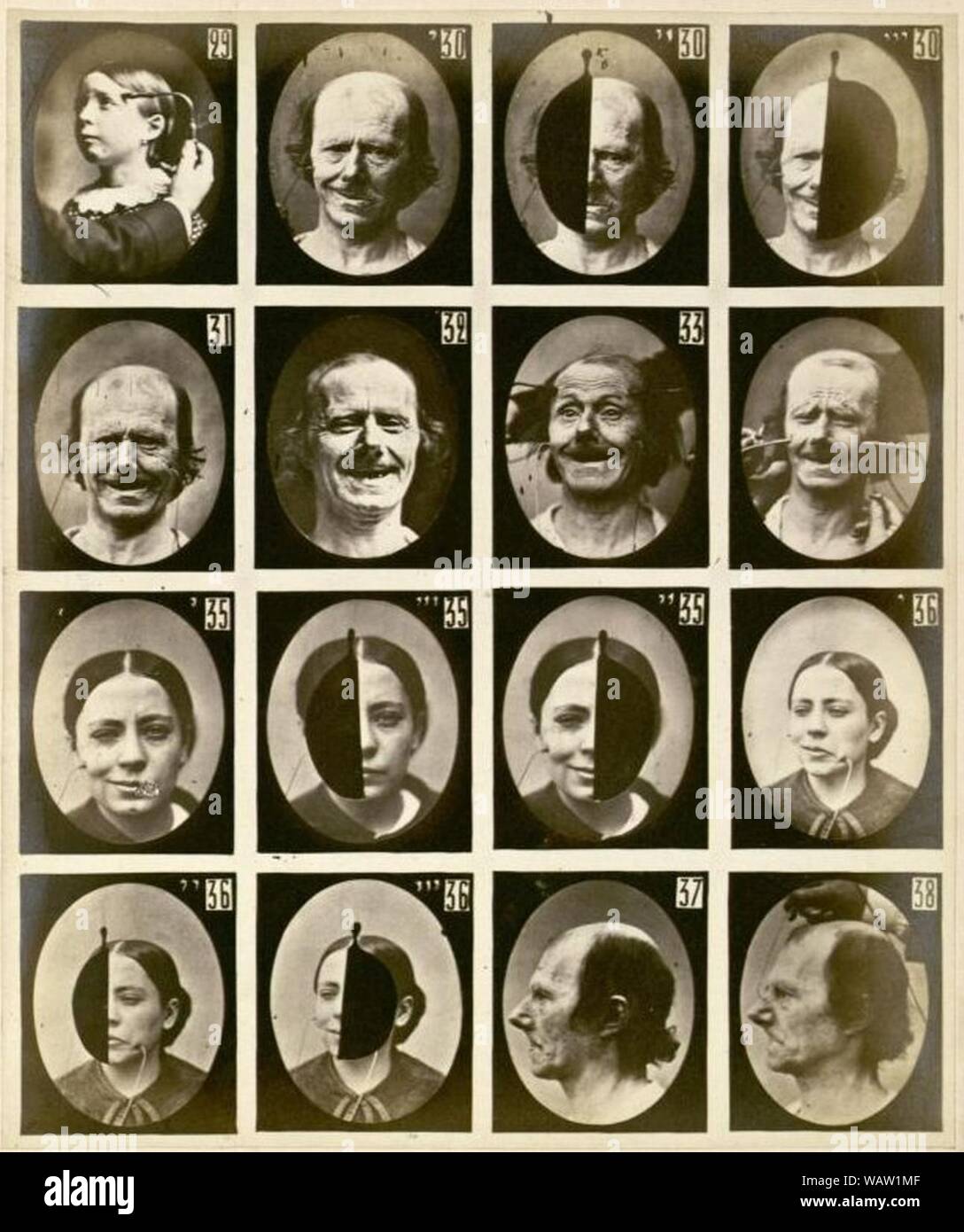 Duchenne hi-res stock photography and images - Alamy