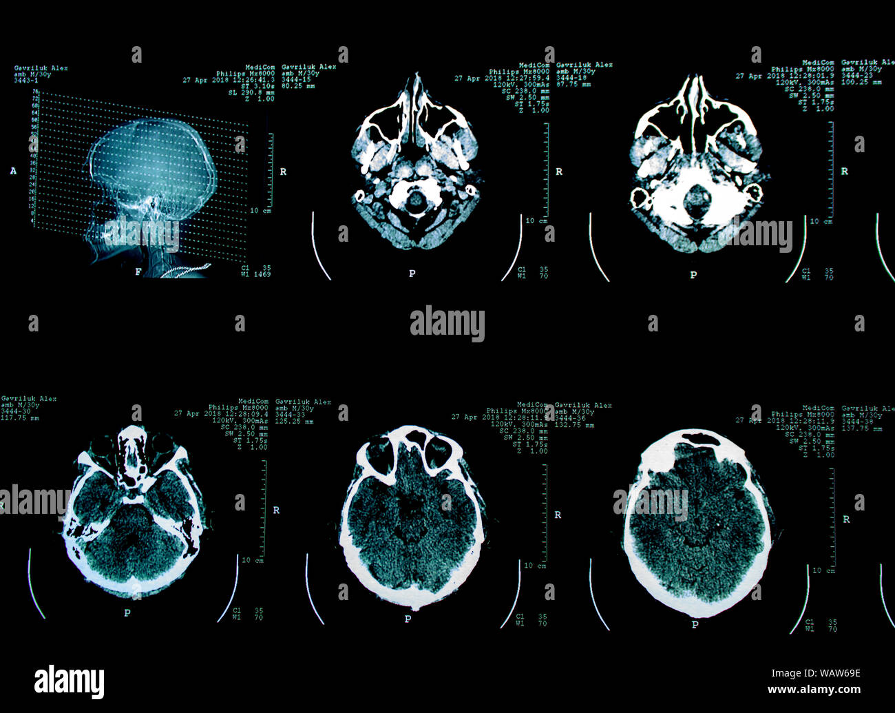 Tomographic hi-res stock photography and images - Alamy
