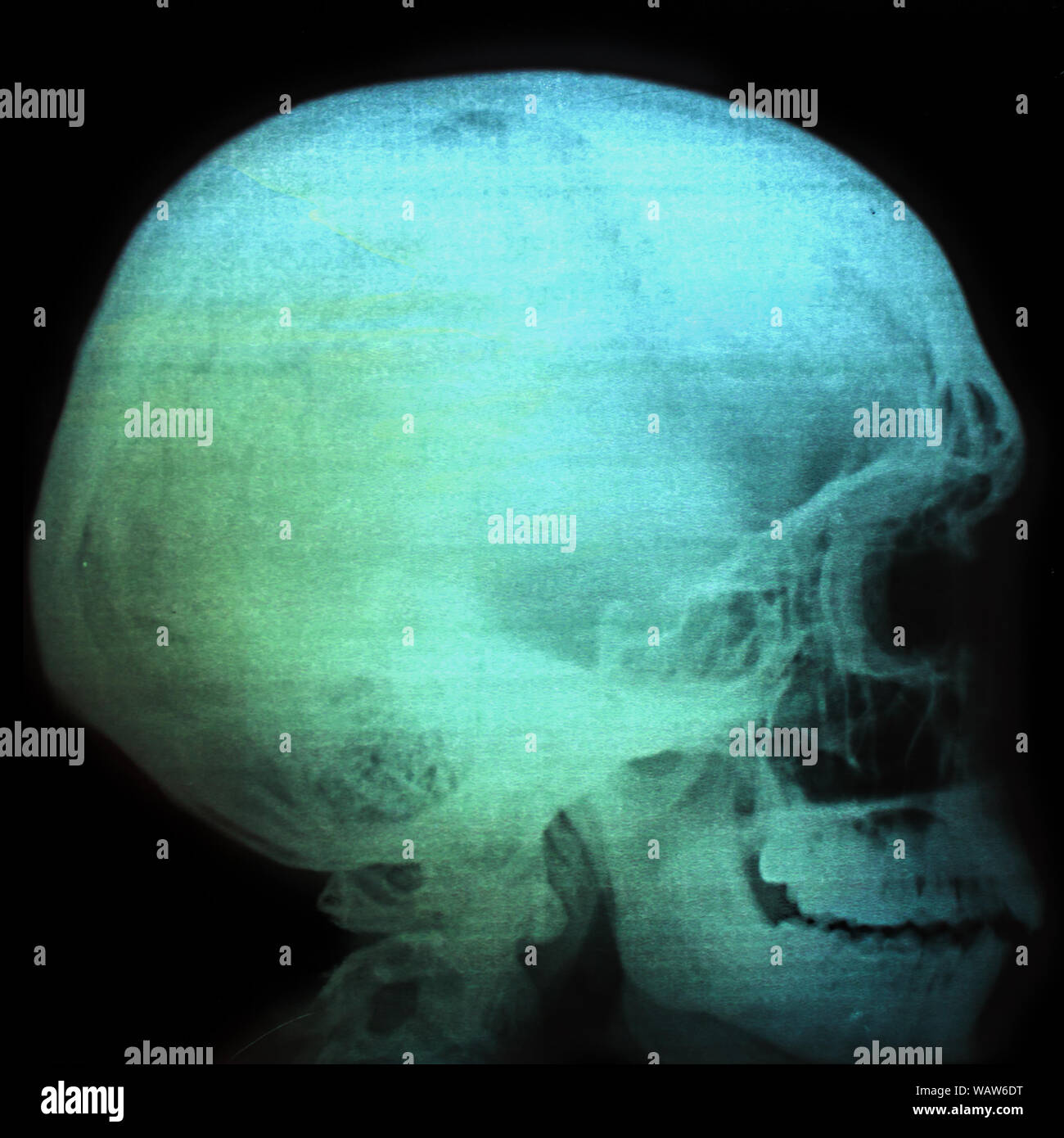 Tomographic hi-res stock photography and images - Alamy