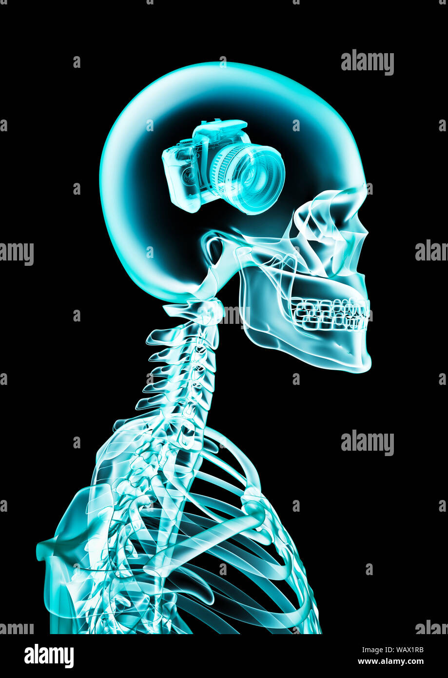 X-ray photographic memory / 3D illustration of human skeleton x-ray ...