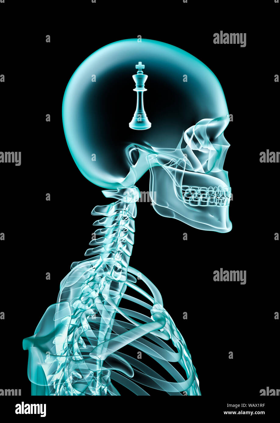 X-ray chess king / 3D illustration of human skeleton x-ray showing chess piece inside head Stock ...