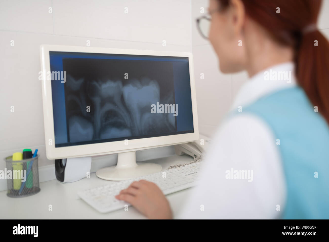 X ray computer screen hi-res stock photography and images - Alamy